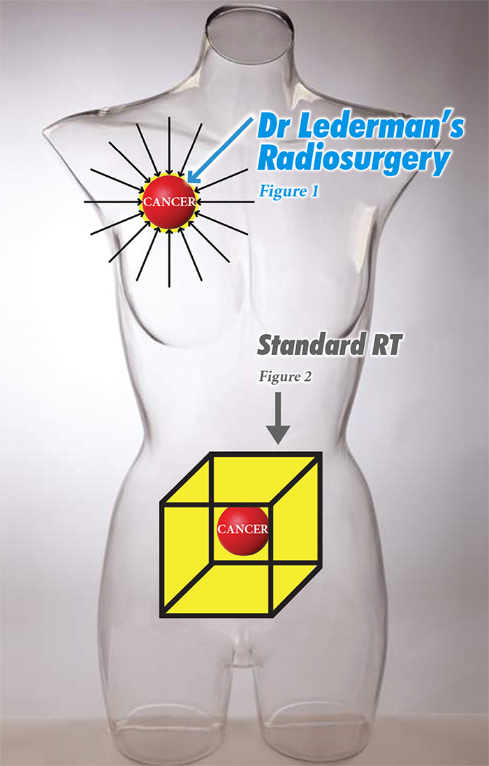 Radiosurgery New York